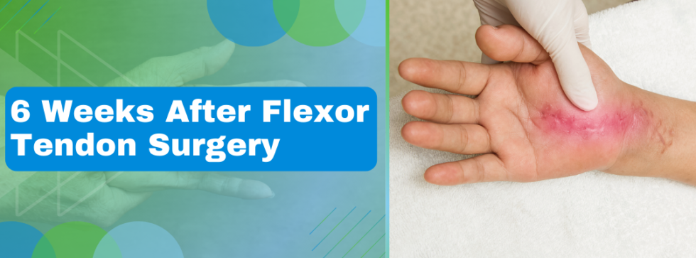 6 Weeks After Flexor Tendon Surgery | Dr Leena Jain